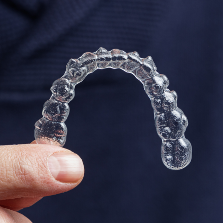 Smile Express® At-Home Aligners | #1 At Home Teeth Straightening Kit